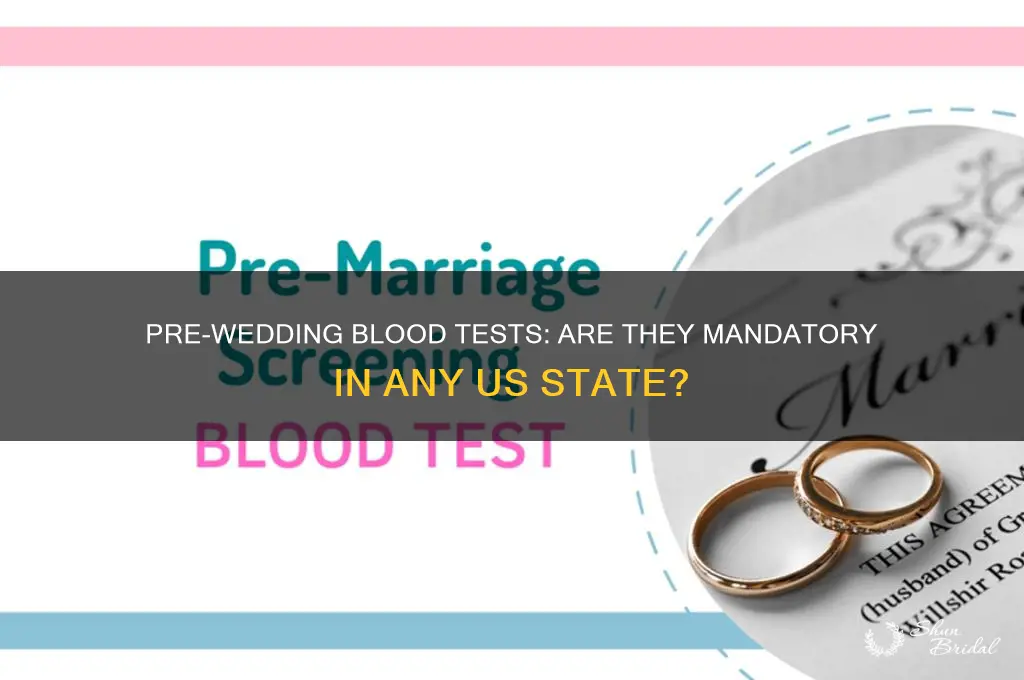 Pre-Wedding Blood Tests: Are They Mandatory In Any Us State? | ShunBridal