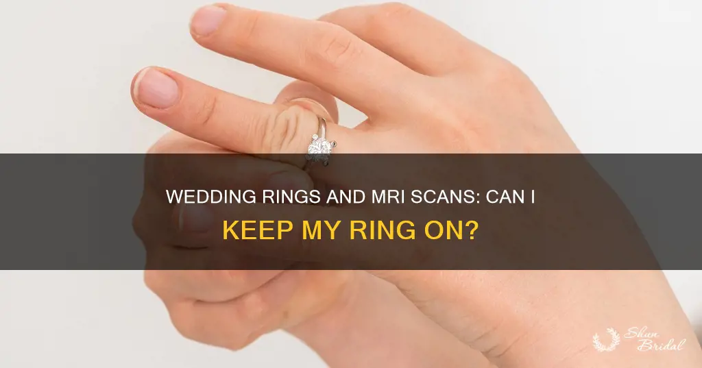 Wedding Rings And Mri Scans: Can I Keep My Ring On? | ShunBridal