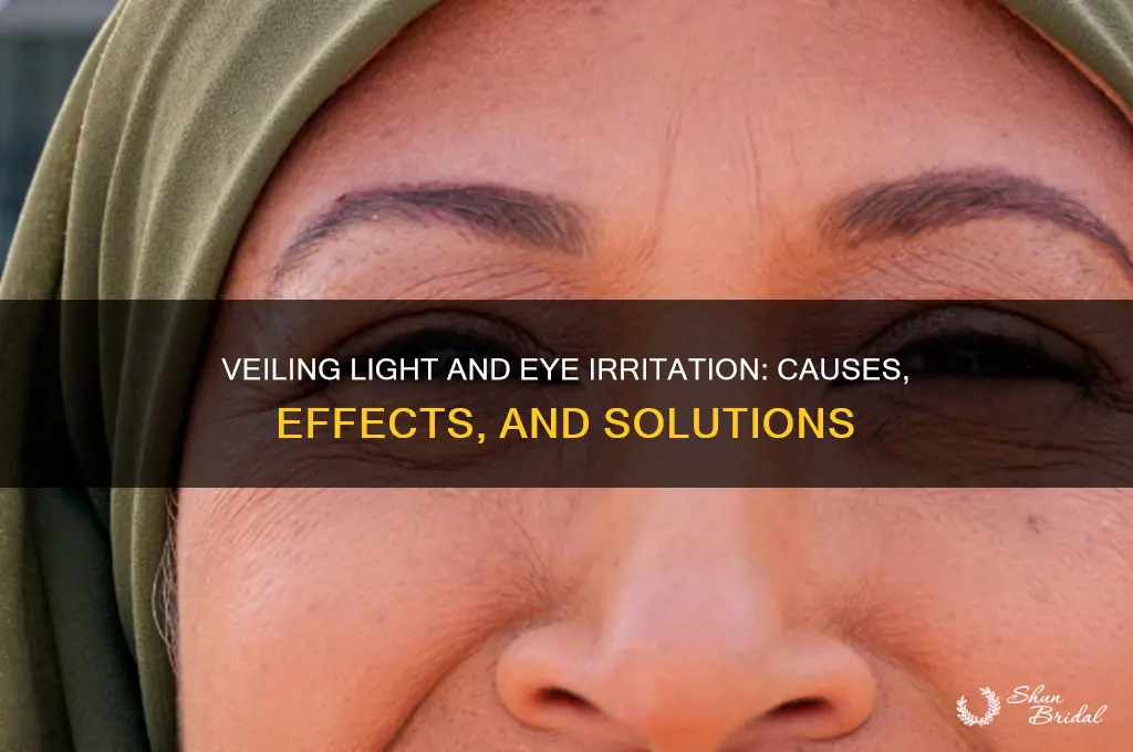 Veiling Light And Eye Irritation: Causes, Effects, And Solutions ...