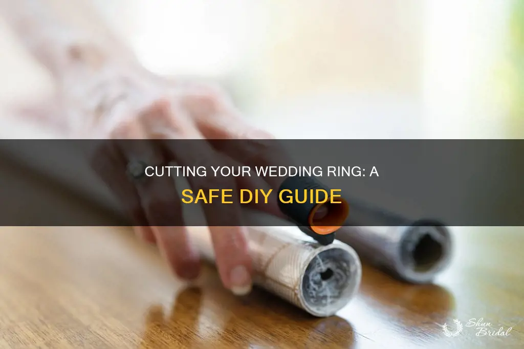 Cutting Your Wedding Ring: A Safe Diy Guide | ShunBridal