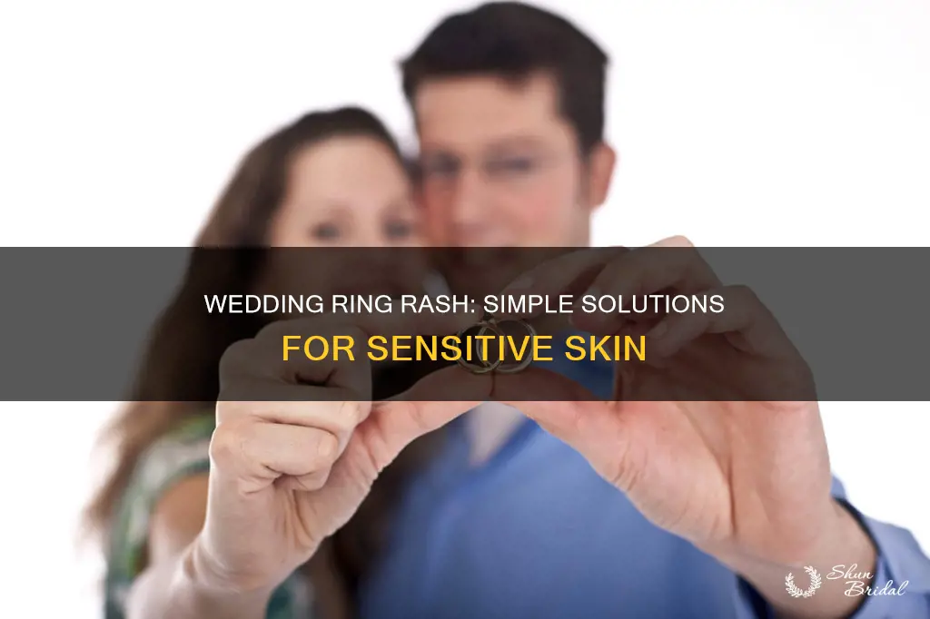 Wedding Ring Rash: Simple Solutions For Sensitive Skin | ShunBridal
