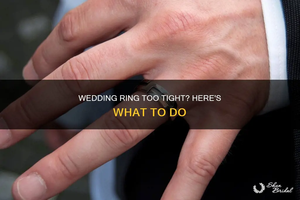Wedding Ring Too Tight? Here's What To Do | ShunBridal