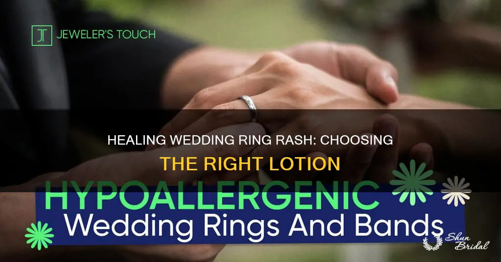 Healing Wedding Ring Rash: Choosing The Right Lotion | ShunBridal