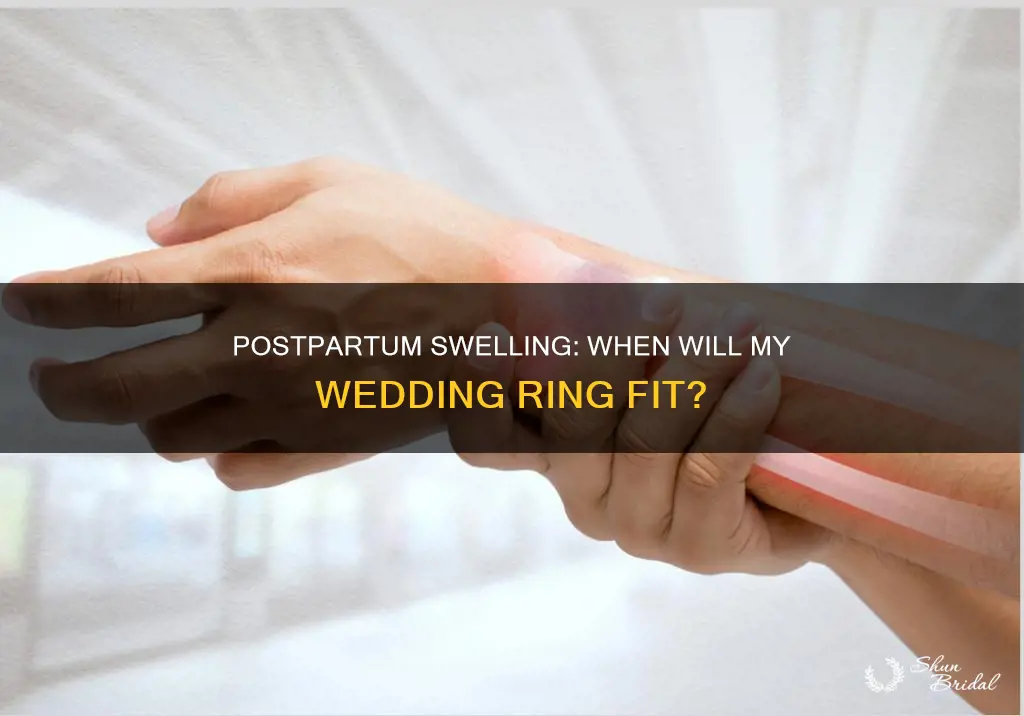Postpartum Swelling: When Will My Wedding Ring Fit? | ShunBridal