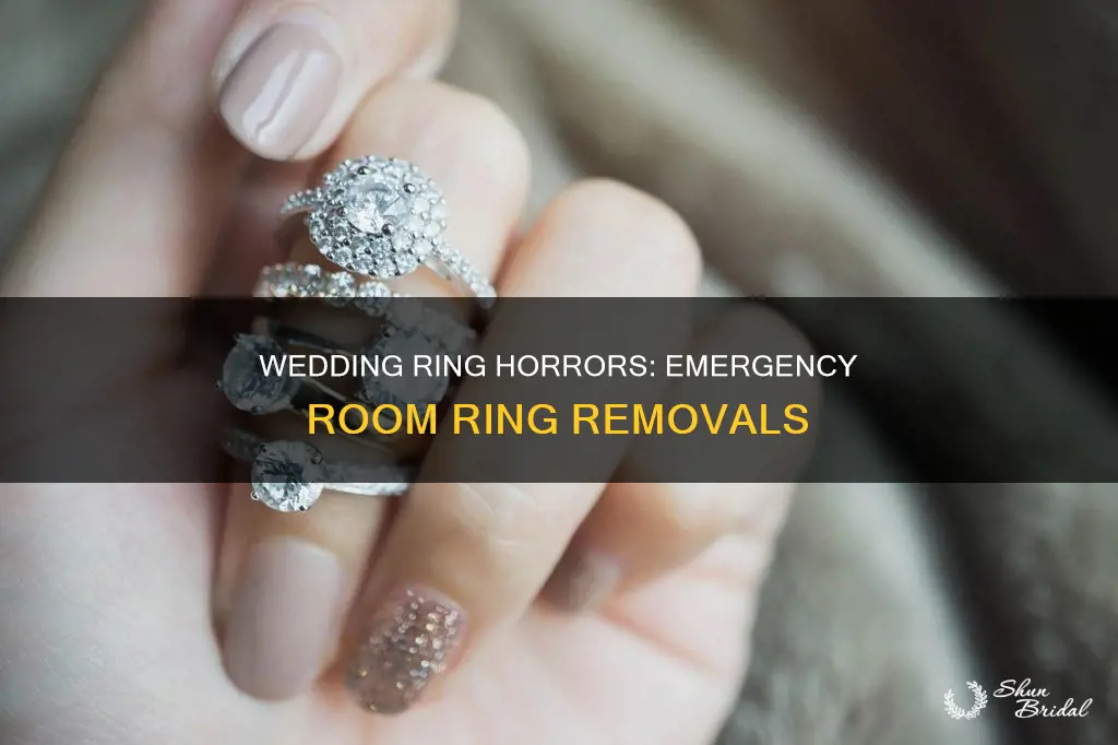 Wedding Ring Horrors: Emergency Room Ring Removals | ShunBridal