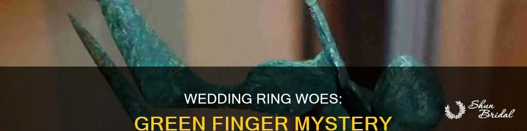 Wedding Ring Woes: Green Finger Mystery | ShunBridal